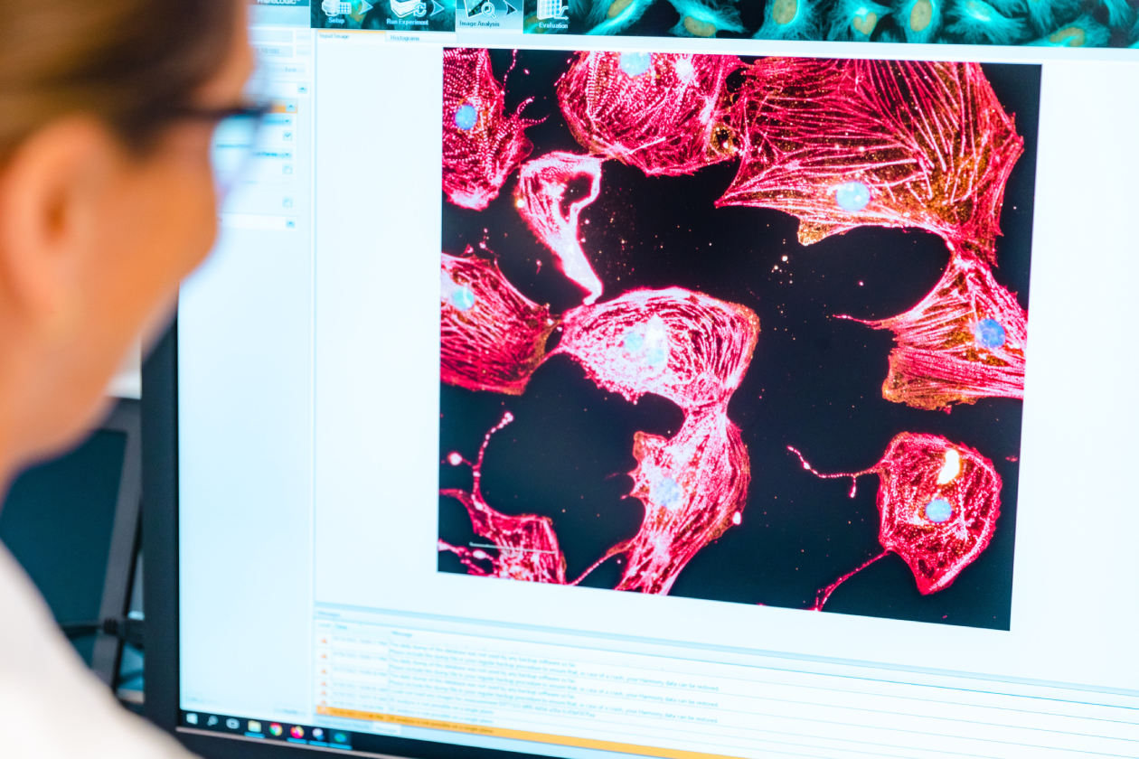 Bayer's Cell Therapy for Replacing Dopamine Neurons in Parkinson’s Advances to Phase III