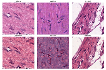 LG AI Research Introduces EXAONEPath: A Specialized Model for ...