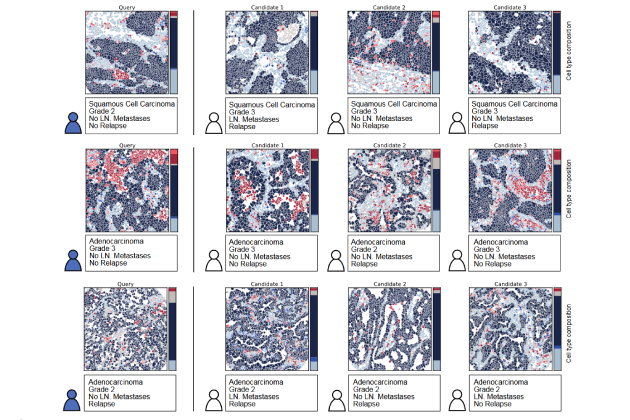 Swiss Researchers Advance Spatial Proteomics with AI-Powered Virtual Tissue Foundation Model