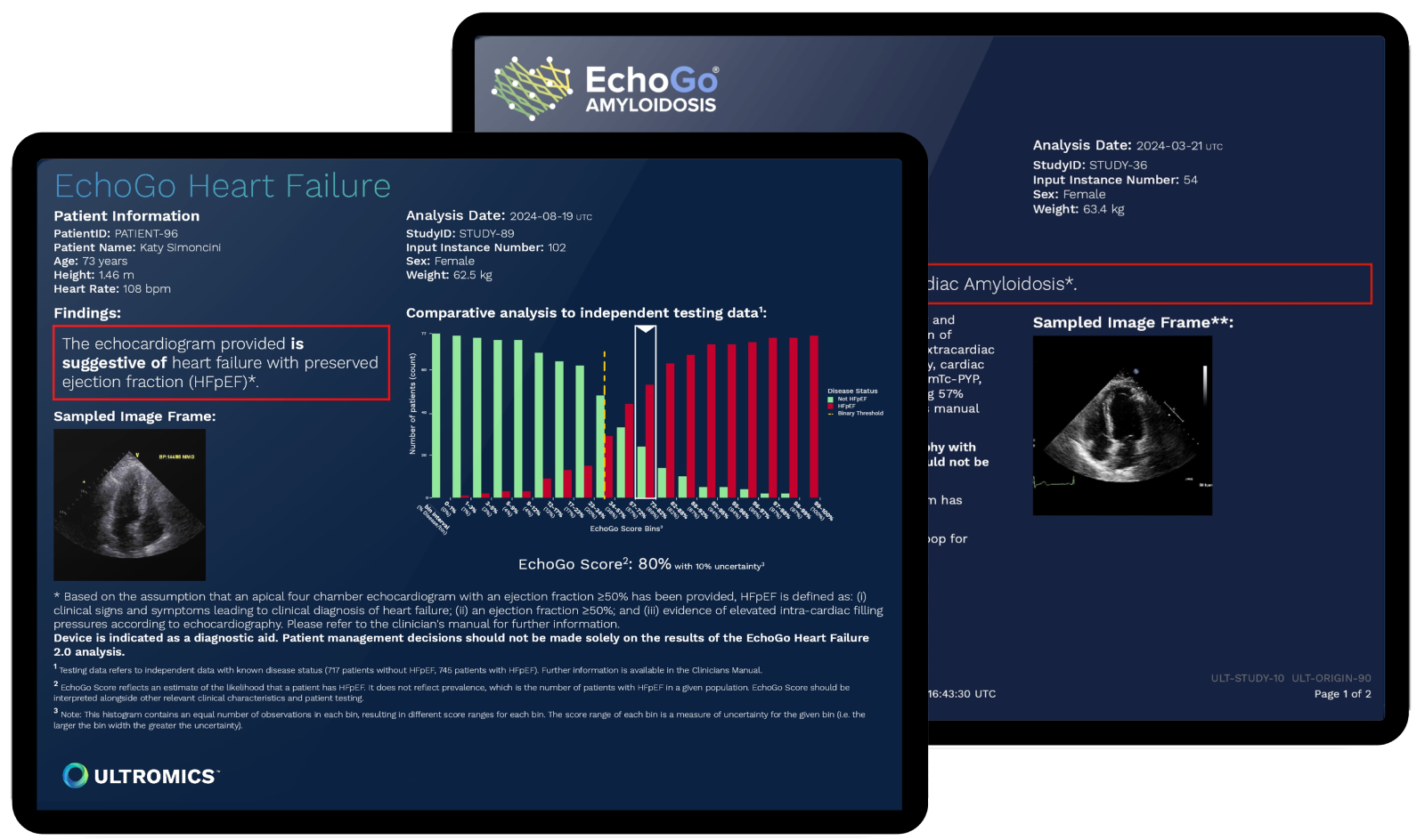 Ultromics Gets $55M to Spot Hidden Heart Failure with AI Ultrasound