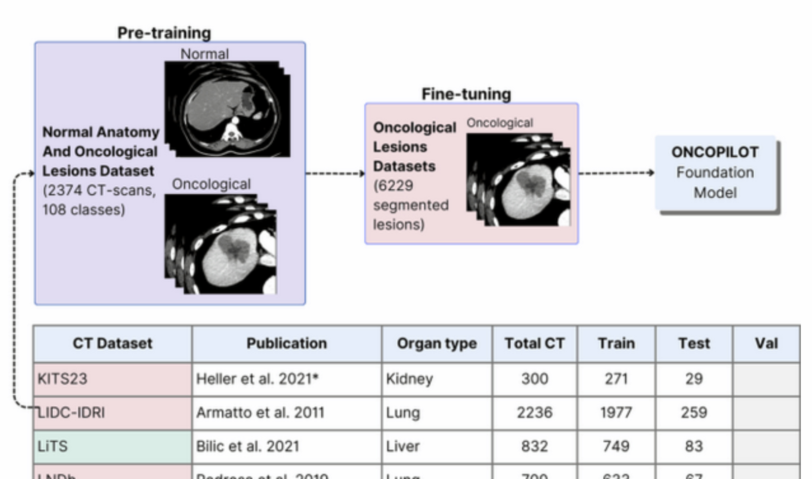 Raidium Publishes Promptable CT Foundation Model for Tumor Segmentation