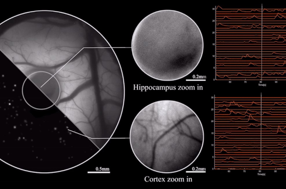 Light-weight Microscope Captures Large-scale Brain Activity in Freely ...